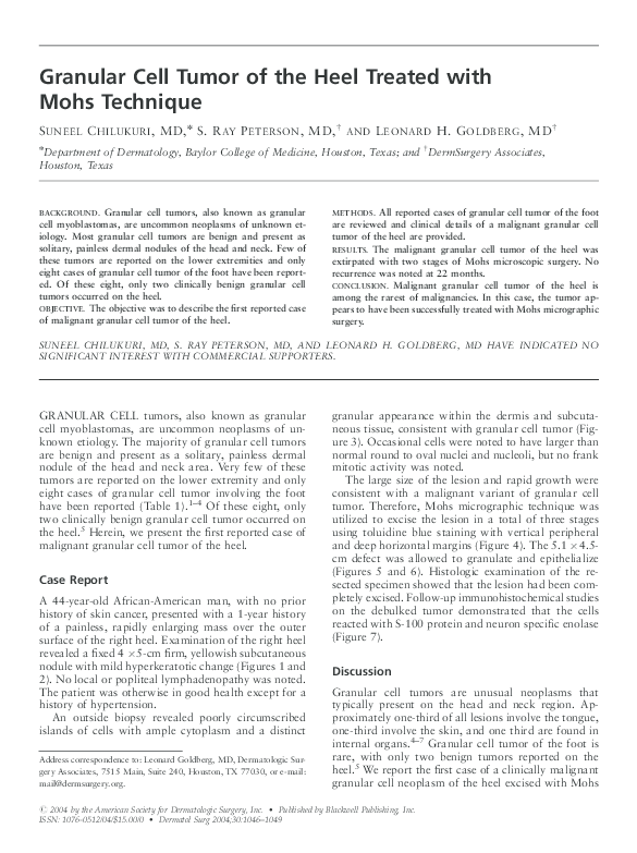 (PDF) Granular Cell Tumor of the Heel Treated with Mohs Technique