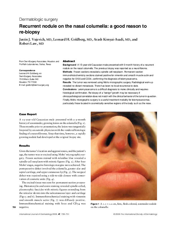 (PDF) Recurrent nodule on the nasal columella: a good reason to re-biopsy