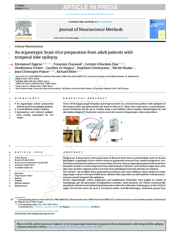 (PDF) An organotypic brain slice preparation from adult patients with ...
