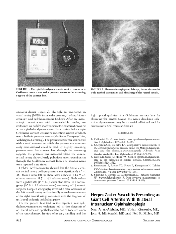 (PDF) Herpes zoster vasculitis presenting as giant cell arteritis with ...