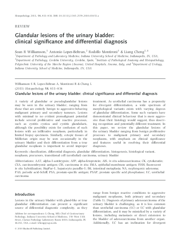 (PDF) Glandular lesions of the urinary bladder:clinical significance ...