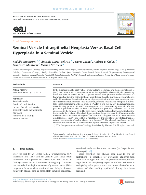 (PDF) Seminal Vesicle Intraepithelial Neoplasia Versus Basal Cell ...