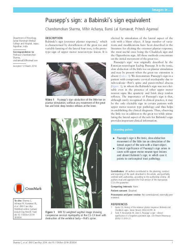 (PDF) Puusepp's sign: a Babinski's sign equivalent