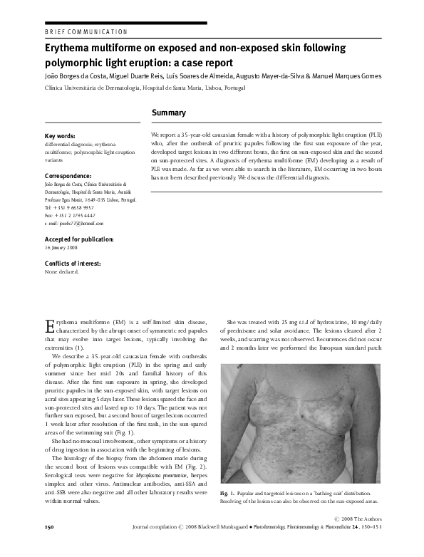 (PDF) Erythema multiforme on exposed and non-exposed skin following ...