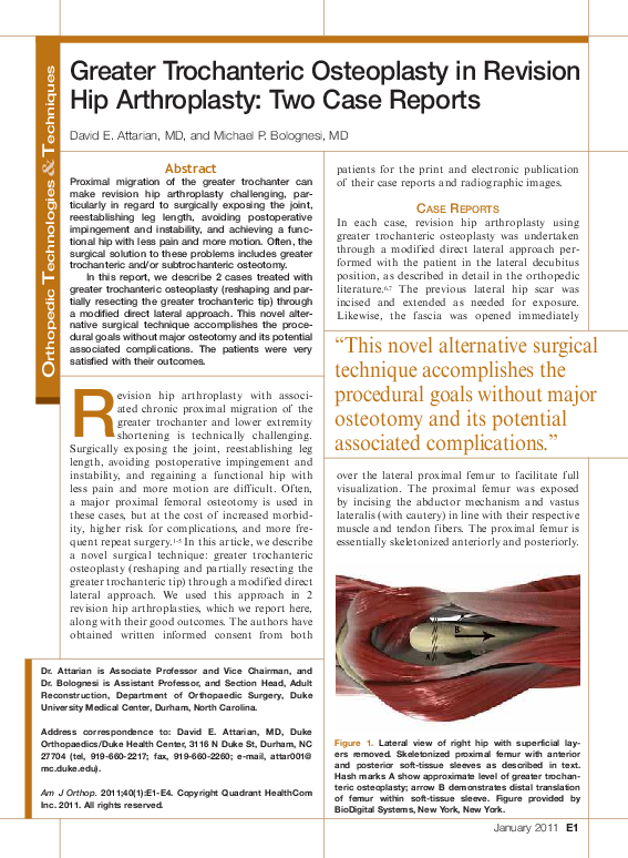 (PDF) Greater trochanteric osteoplasty in revision hip arthroplasty ...