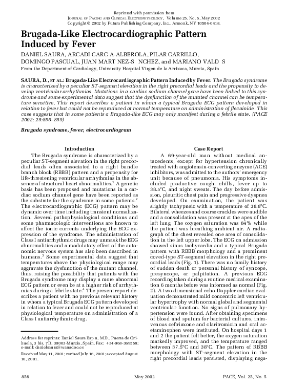 (PDF) Brugada-Like Electrocardiographic Pattern Induced by Fever