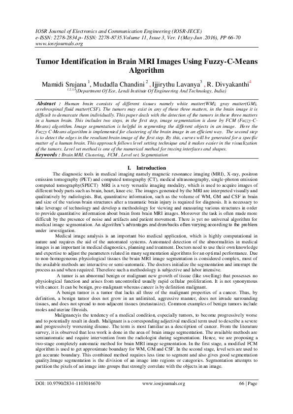 Pdf Tumor Identification In Brain Mri Images Using Fuzzy C Means Algorithm