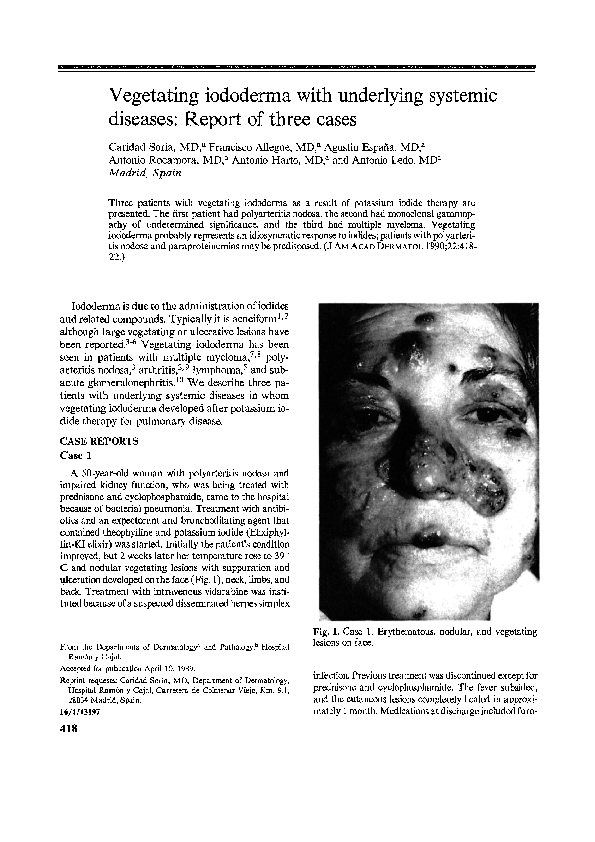 (PDF) Vegetating iododerma with underlying systemic diseases: Report of ...
