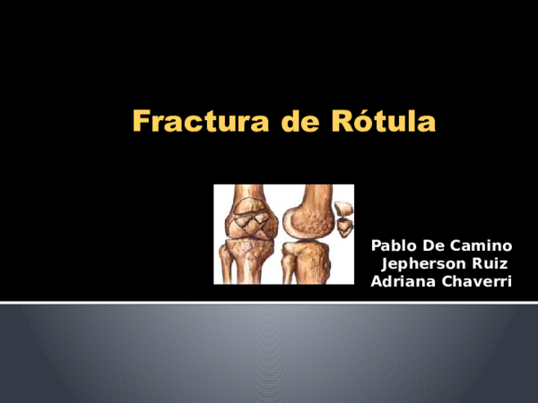 (PPT) Fractura de rotula