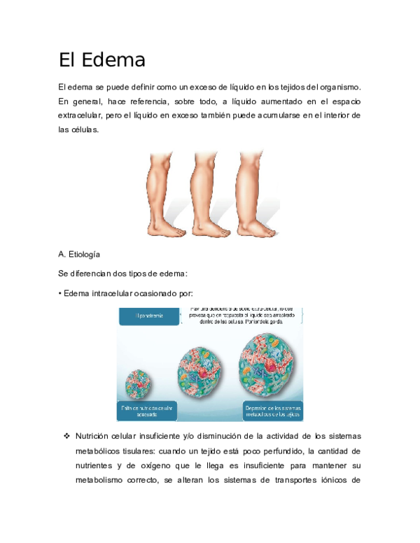 (DOC) El Edema