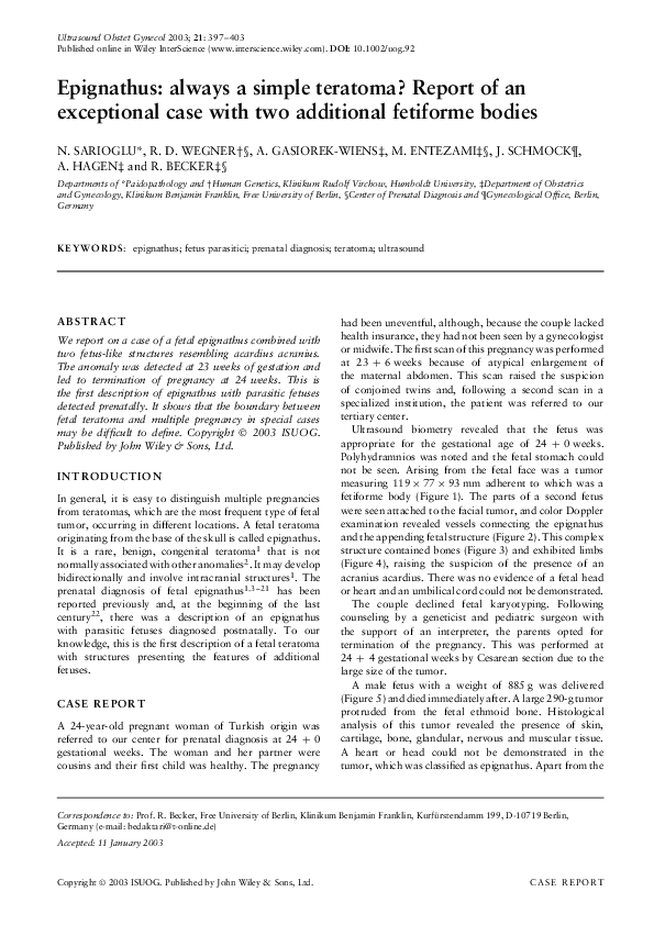 (PDF) Epignathus: always a simple teratoma? Report of an exceptional ...