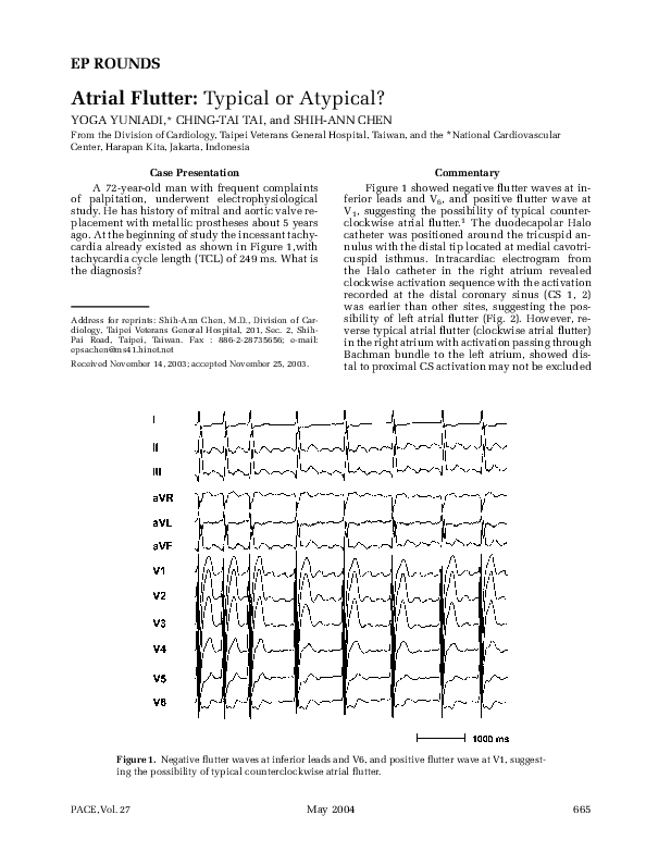 (PDF) Atrial Flutter:. Typical or Atypical? | Yoga Yuniadi - Academia.edu