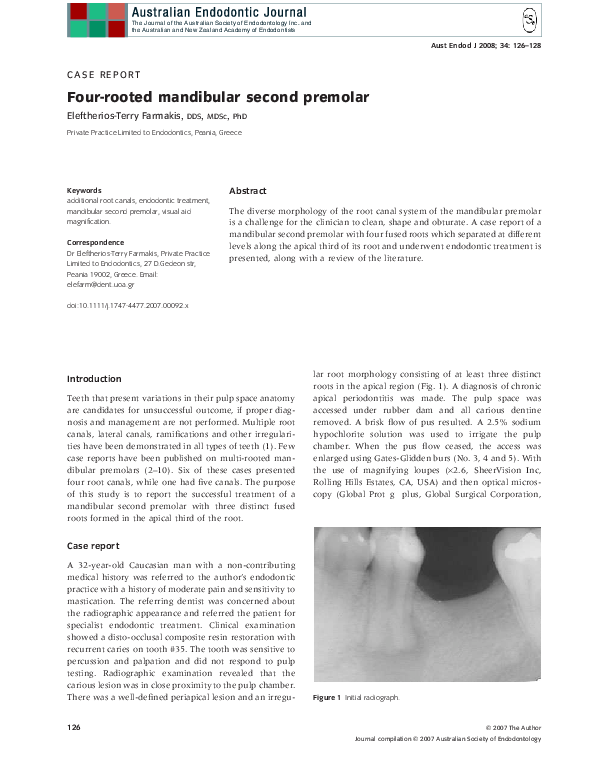 (PDF) Four-rooted mandibular second premolar