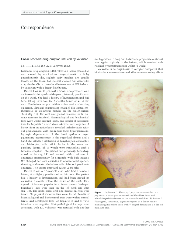(PDF) Linear lichenoid drug eruption induced by valsartan