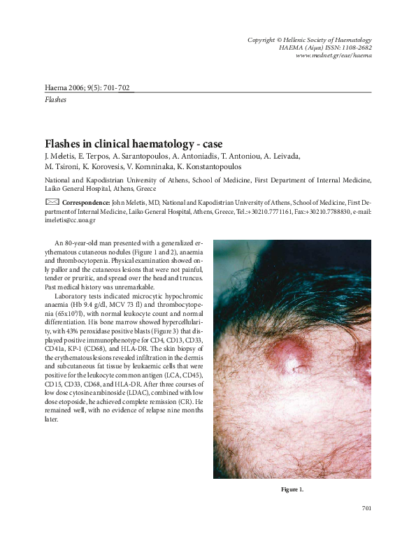 (PDF) Aml (M4)-LEUKEMIA Cutis | John Meletis - Academia.edu