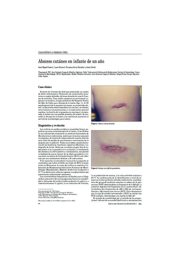 (PDF) Absceso cutáneo en infante de un año