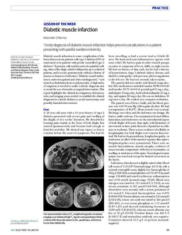 (PDF) Diabetic muscle infarction | Malvinder Parmar - Academia.edu