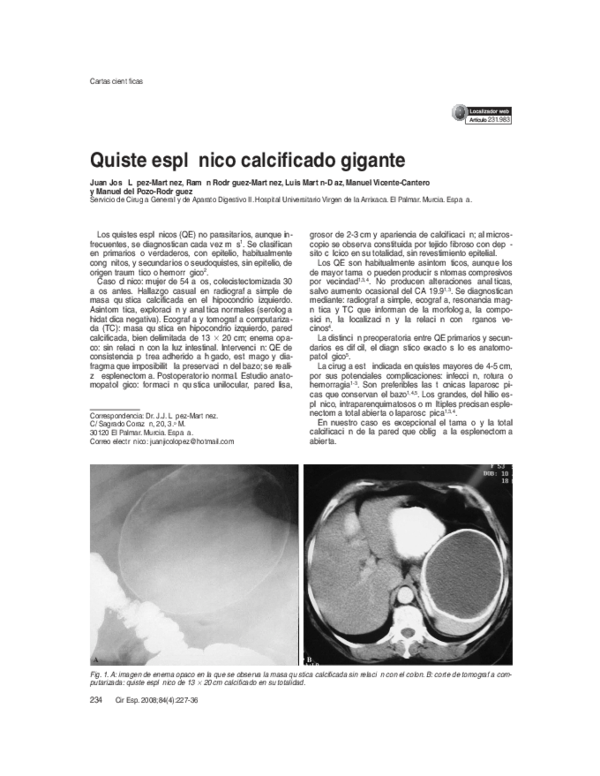 (PDF) Quiste esplénico calcificado gigante