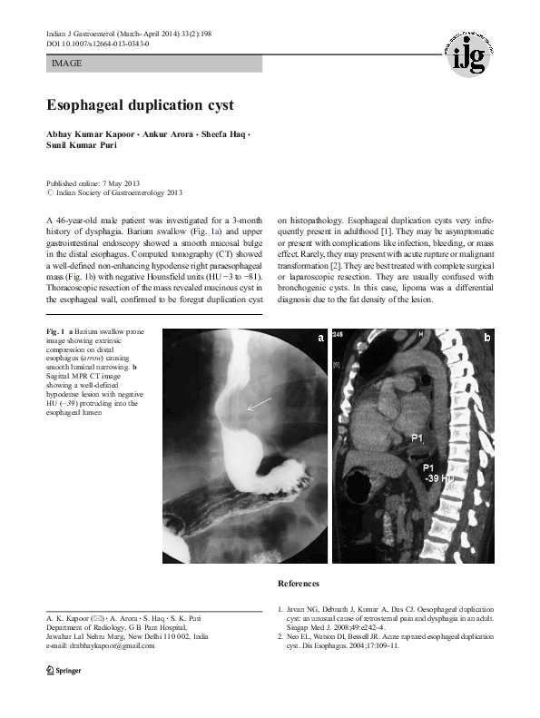 Pdf Esophageal Duplication Cyst
