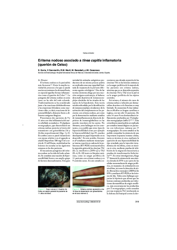 (PDF) Eritema nodoso asociado a tinea capitis inflamatoria (querión de ...