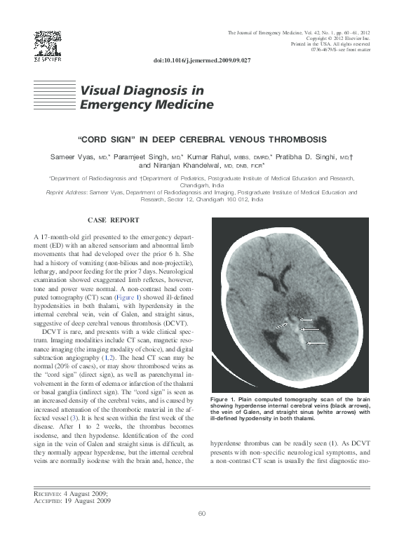 (PDF) Cord Sign” in Deep Cerebral Venous Thrombosis