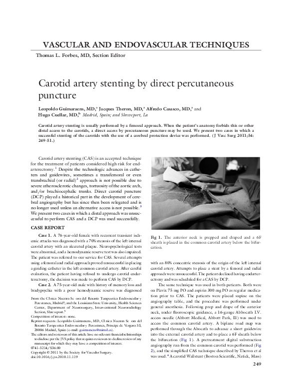 (PDF) Carotid artery stenting by direct percutaneous puncture