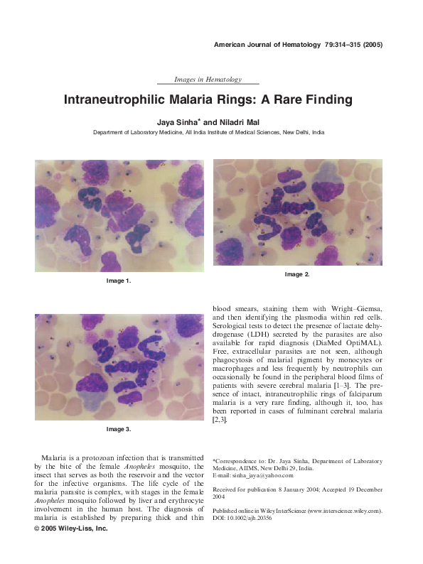 (PDF) Intraneutrophilic malaria rings: A rare finding