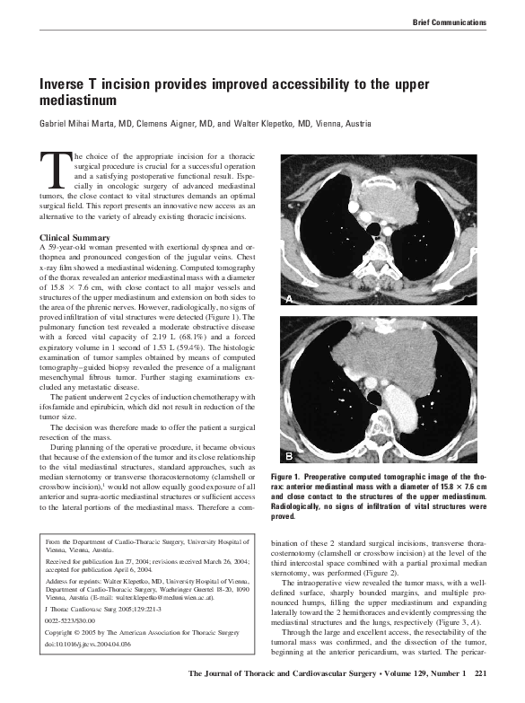 (PDF) Inverse T incision provides improved accessibility to the upper ...