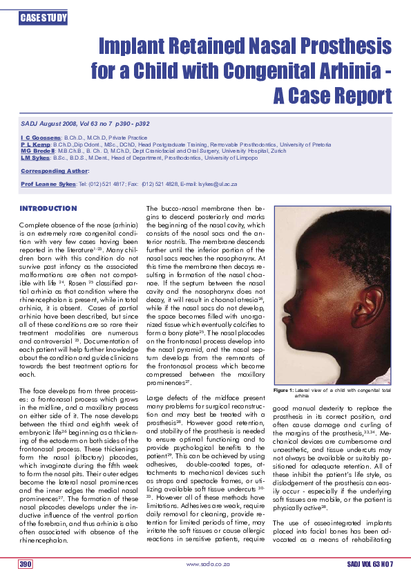 Implant retained nasal prosthesis for a child with congenital arhinia ...