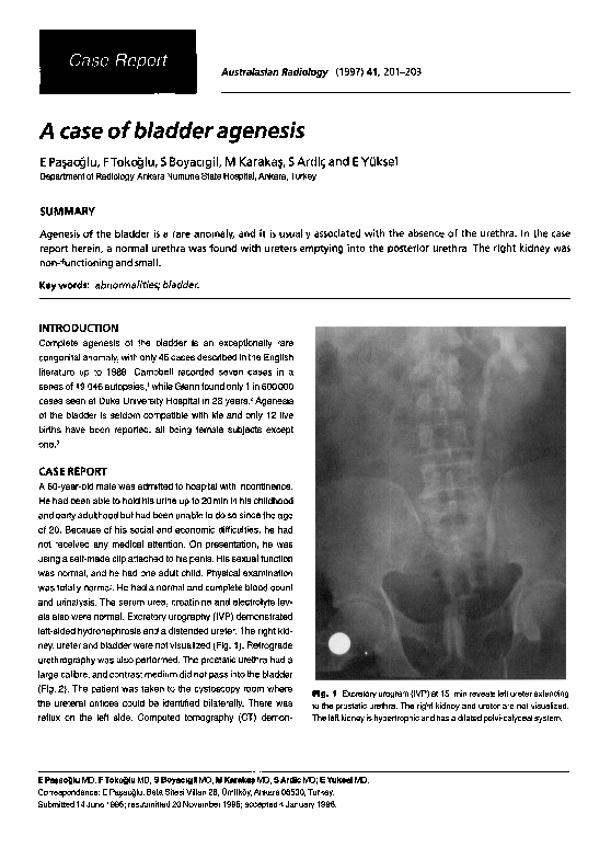 (PDF) A case of bladder agenesis