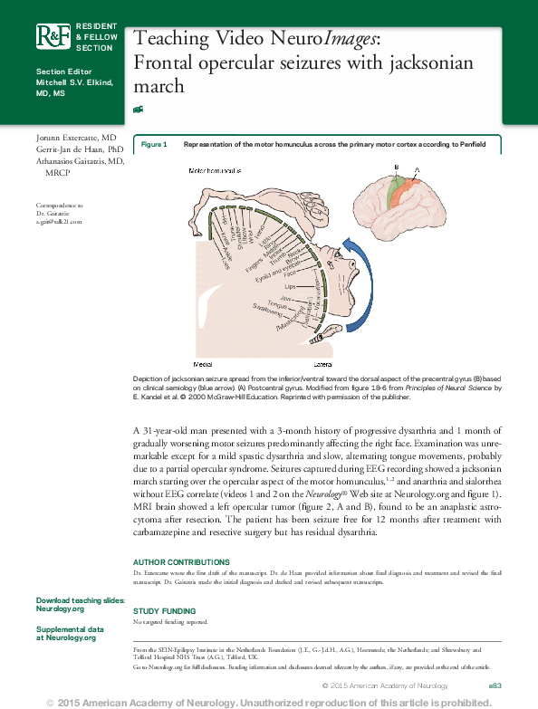 (PDF) Teaching Video NeuroImages: Frontal opercular seizures with ...