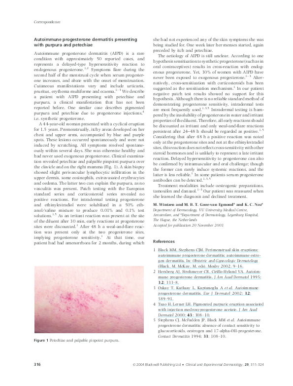 (PDF) Autoimmune progesterone dermatitis presenting with purpura and ...
