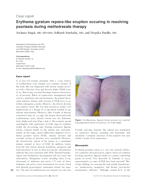 Erythema Gyratum Repens