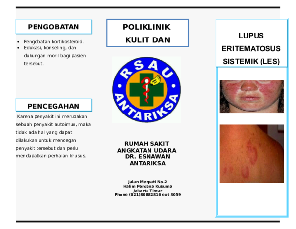 (DOC) Leaflet SLE 3 | Tika Wirawan - Academia.edu