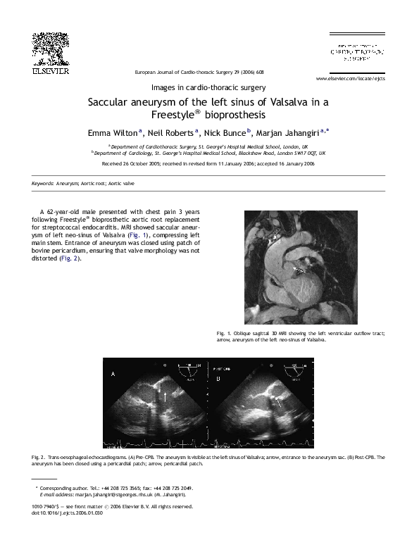 (PDF) Saccular aneurysm of the left sinus of Valsalva in a Freestyle ...