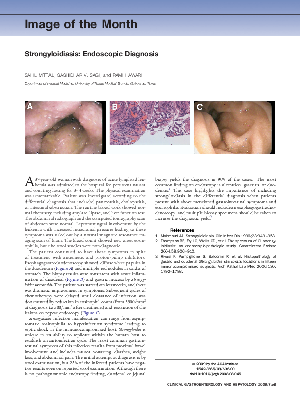(PDF) Strongyloidiasis: Endoscopic Diagnosis