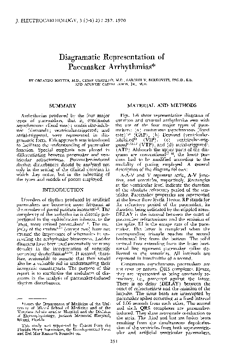 (PDF) Diagramatic representation of pacemaker arrhythmias