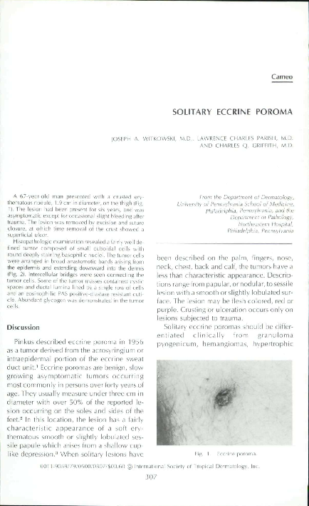 (PDF) Solitary Eccrine Poroma