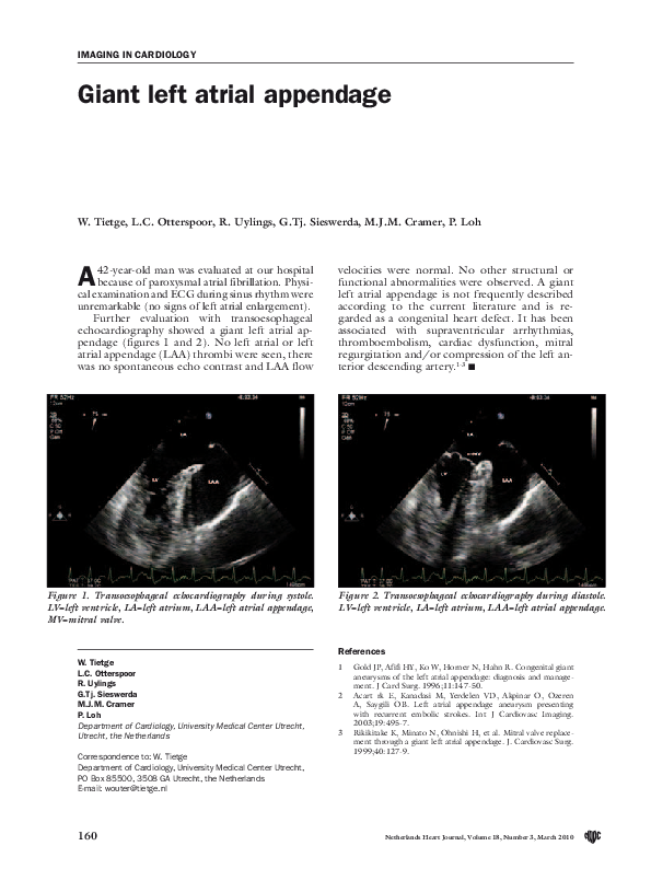 (PDF) Giant left atrial appendage