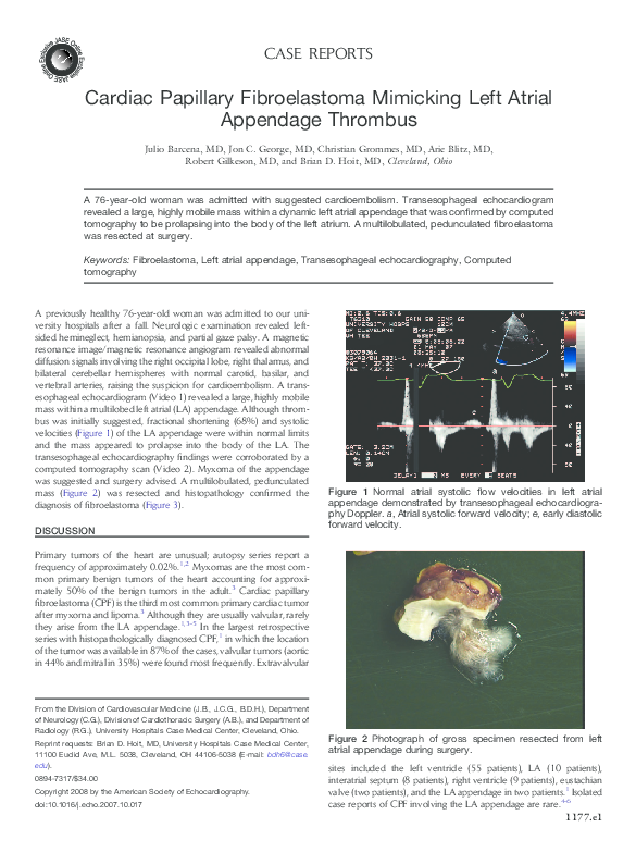 (PDF) Cardiac Papillary Fibroelastoma Mimicking Left Atrial Appendage ...