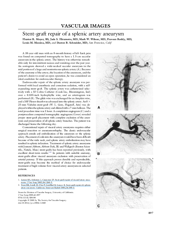 (PDF) Stent-graft repair of a splenic artery aneurysm