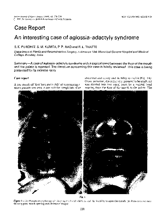 (PDF) An interesting case of aglossia-adactyly syndrome