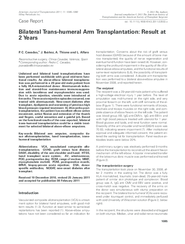 (PDF) Bilateral Trans-humeral Arm Transplantation: Result at 2 Years