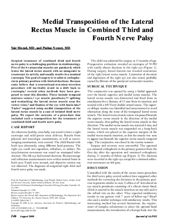 (PDF) Medial transposition of the lateral rectus muscle in combined ...