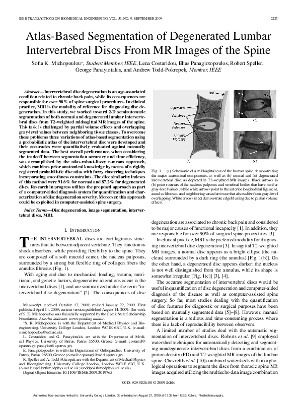 Pdf Atlas Based Segmentation Of Degenerated Lumbar Intervertebral