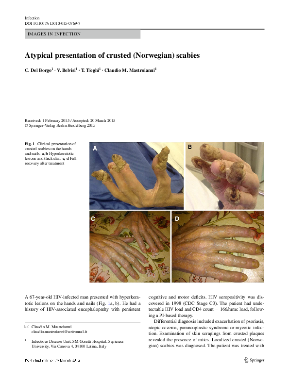 (PDF) Atypical presentation of crusted (Norwegian) scabies