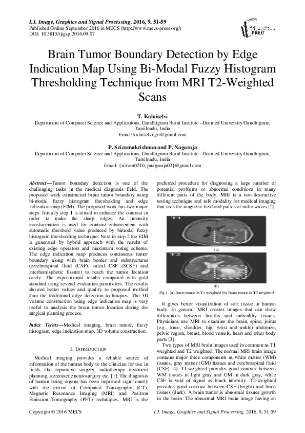 Pdf Brain Tumor Boundary Detection By Edge Indication Map Using Bi Modal Fuzzy Histogram