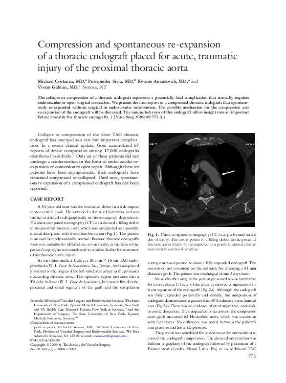 (PDF) Compression and spontaneous re-expansion of a thoracic endograft ...