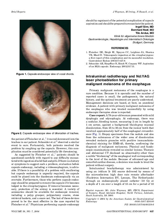 (PDF) Intraluminal radiotherapy and Nd:YAG laser photoablation for ...