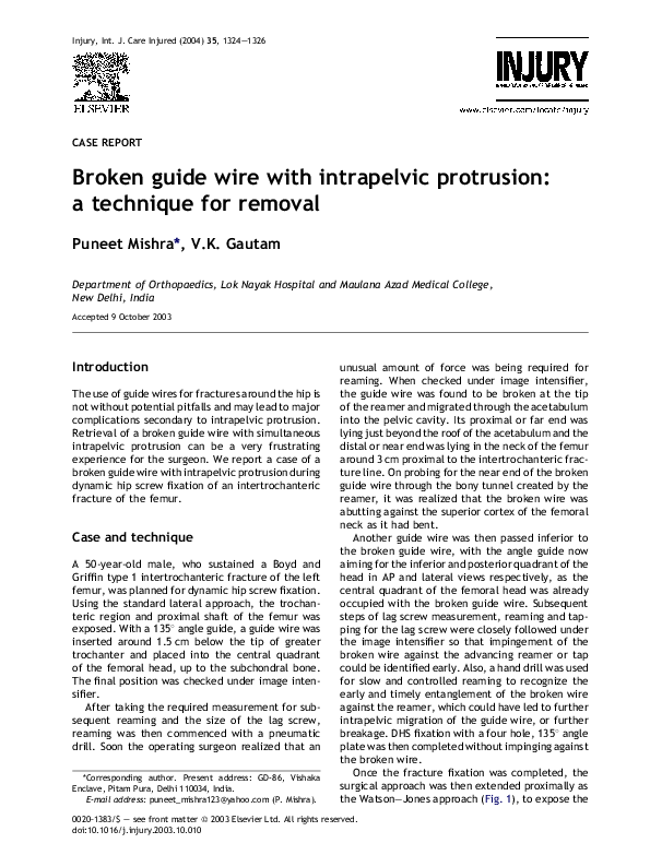 (PDF) Broken guide wire with intrapelvic protrusion: a technique for ...